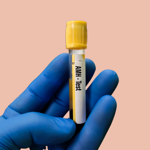 Getting your AMH test in Bangalore - Dr. Chaitra | Fertility Expert