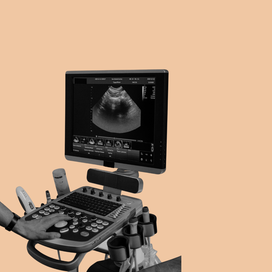 Interval Growth Scan - Dr. Chaitra | Fertility Expert